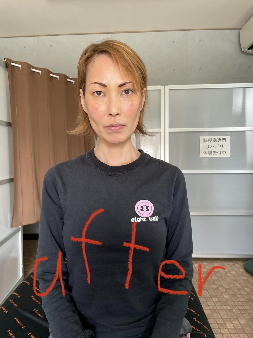 魔法のコツbefore after - Axis Support