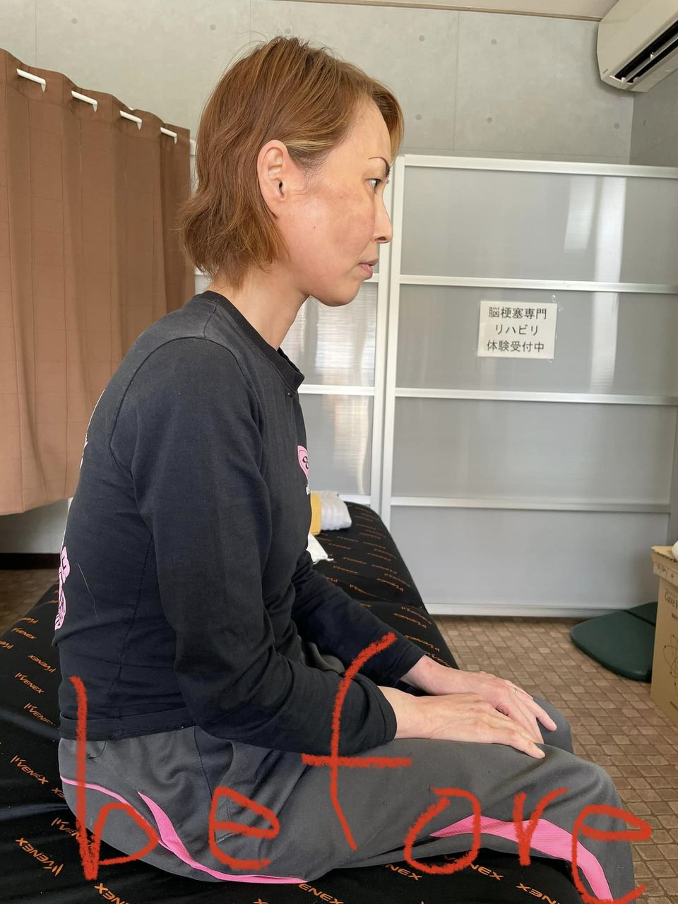 魔法のコツbefore after - Axis Support