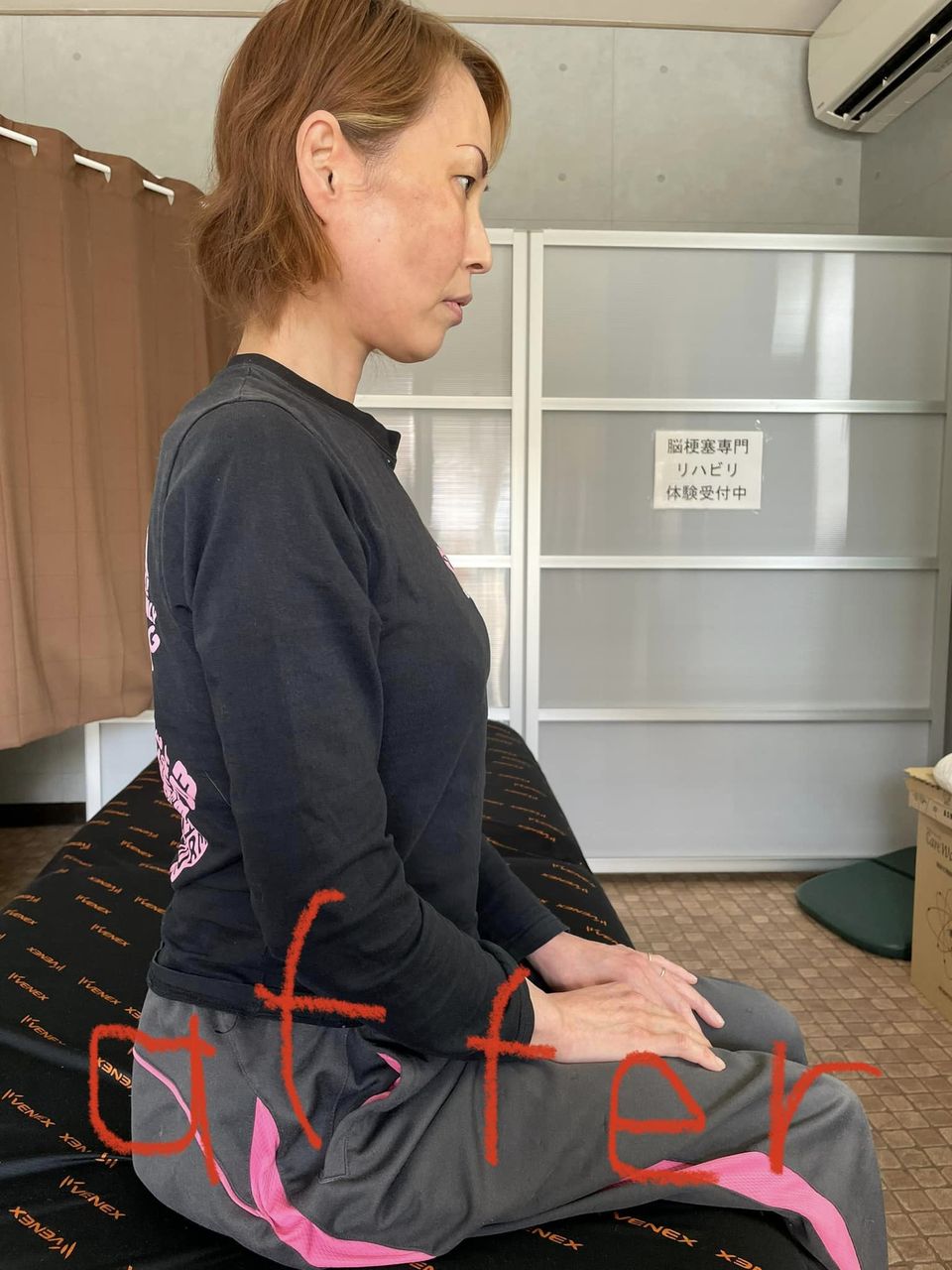 魔法のコツbefore after - Axis Support